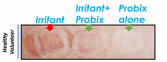 PROBIX - LACTOBACILLUS FERMENT LYSATE - Biotix - Anti-Aging Agent