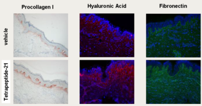 TEGO Pep - 4-17 MB - Evonik - Tetrapeptide-21 - Anti-Aging Agent