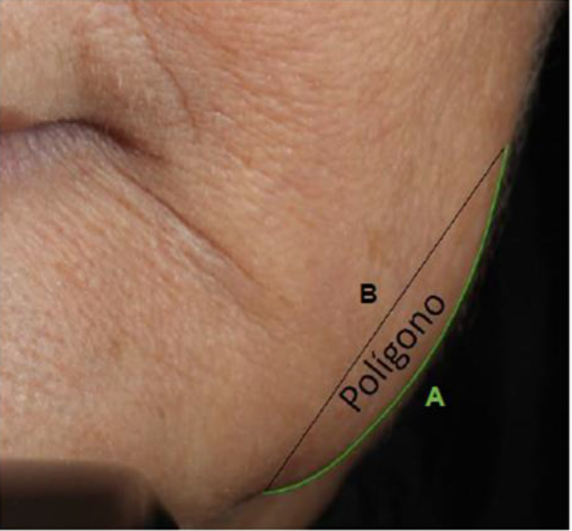 TEGO Pep - UP - Evonik - Tetrapeptide-4 - Anti-Aging Agent