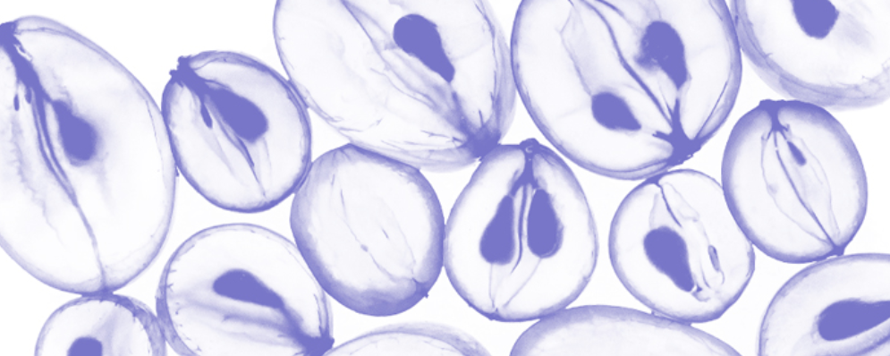 Activ'Inside - Neuronutrition - Nutricosmetics - Knowde